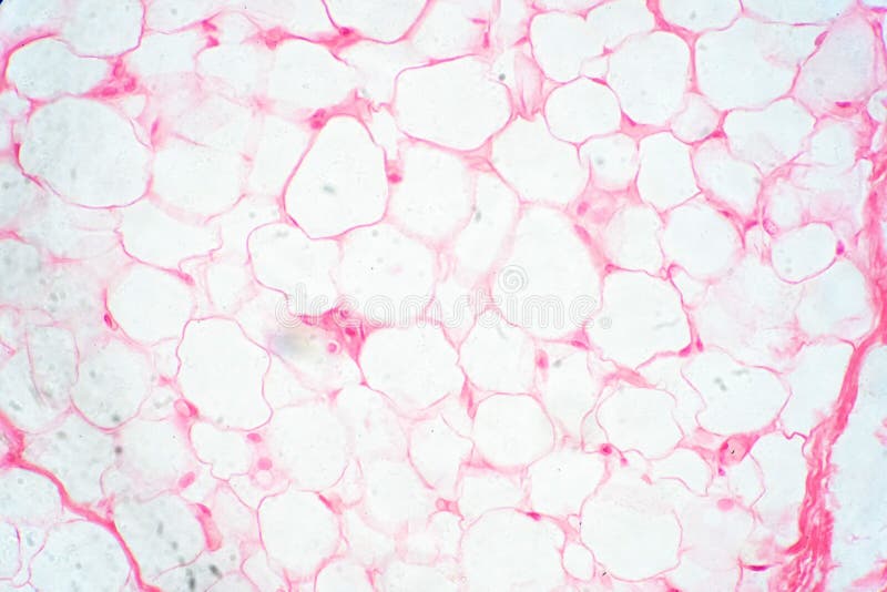 Human Fat Body Tissue Under Microscope View Stock Image - Image of care ...