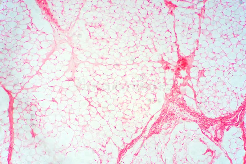 Human Fat Body Tissue Under Microscope View Stock Photo - Image of ...