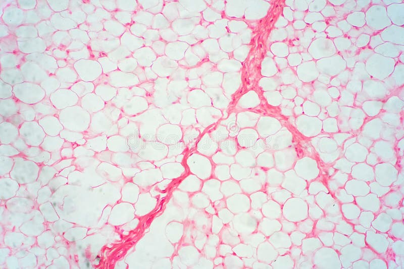 331 Fat Cell Microscope Stock Photos - Free & Royalty-Free Stock Photos ...