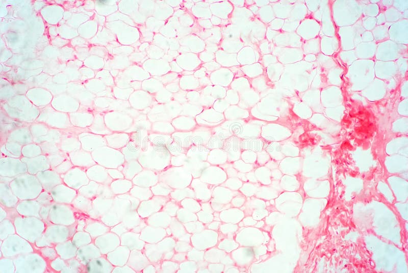 Human Fat Body Tissue Under Microscope View Stock Image - Image of ...