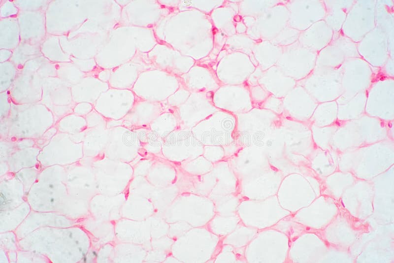 Human Fat Body Tissue Under Microscope View Stock Photo - Image of ...