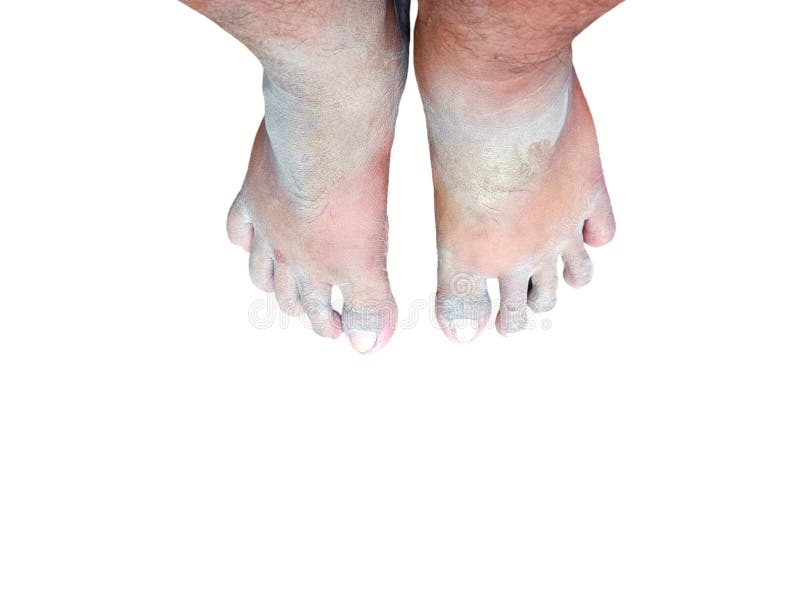 Human Feet Dirty and Full of Dust on a White Background Stock Photo ...