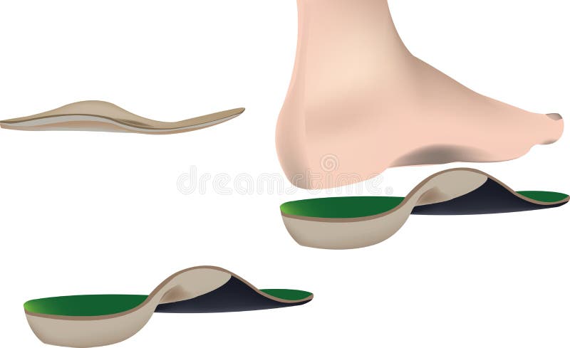 Human Feet with Use of Insoles- Stock Vector - Illustration of fitting ...