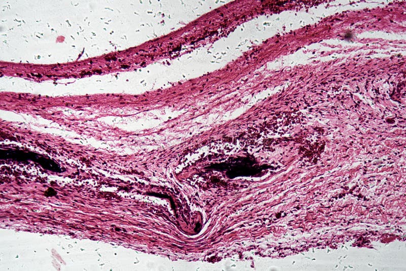 Human Fetal Head Under the Microscope Stock Photo - Image of care ...