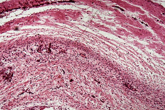 Human Fetal Head Under the Microscope Stock Photo - Image of care ...