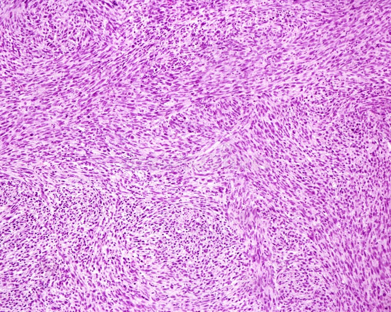 Micrograph Split Stock Illustrations – 7 Micrograph Split Stock ...