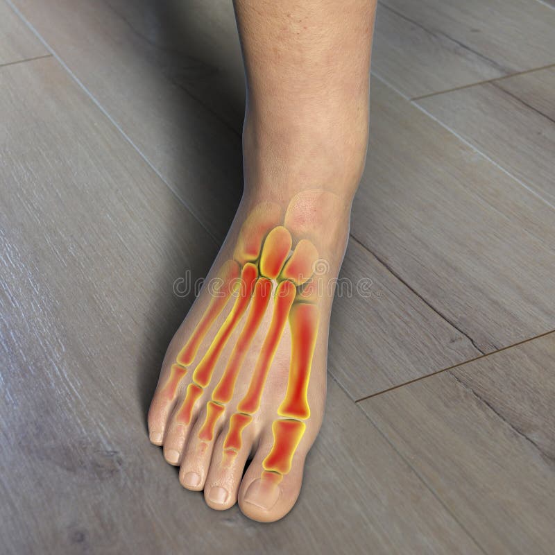 Highlighted Foot Stock Illustrations – 141 Highlighted Foot Stock ...