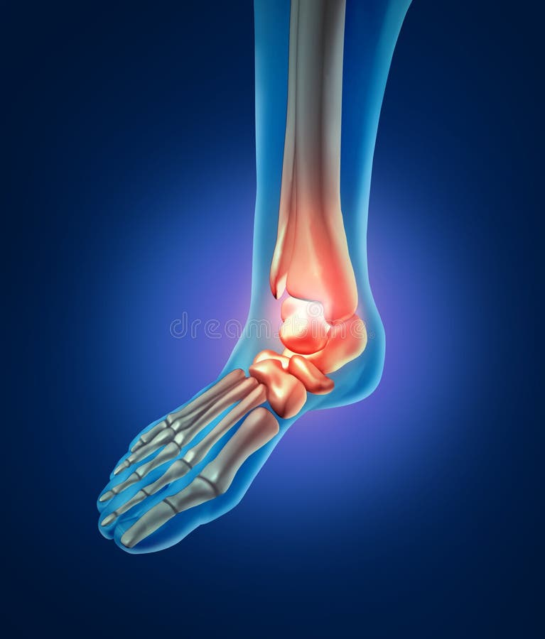 Human Foot Pain stock illustration. Illustration of ankle - 23315767
