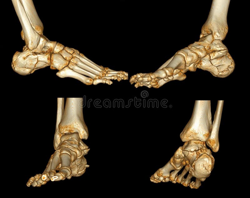 Foot Examination Stock Illustrations – 455 Foot Examination Stock ...
