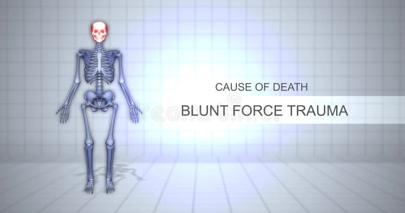 Human Forensic Autopsy Animation Concept - Cause of Death - Blunt Force ...