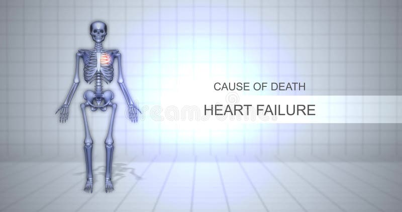 Human Forensic Autopsy Animation Concept - Cause of Death - Heart ...