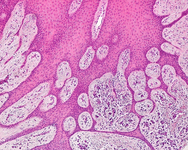 Human Gingiva Epithelium. Rete Ridges Stock Image - Image of epithelial ...