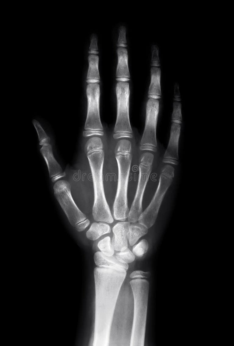 2,192 Human Hand Palm Anatomy Stock Photos - Free & Royalty-Free Stock ...