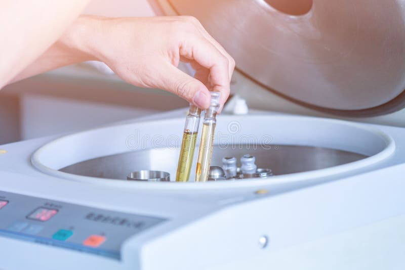 Human Hand Adding Test Tubes in Centrifuge Stock Image - Image of ...