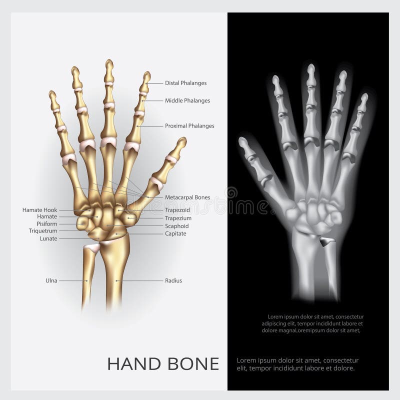 Human Hand Bone Vector Illustration Stock Vector - Illustration of ...