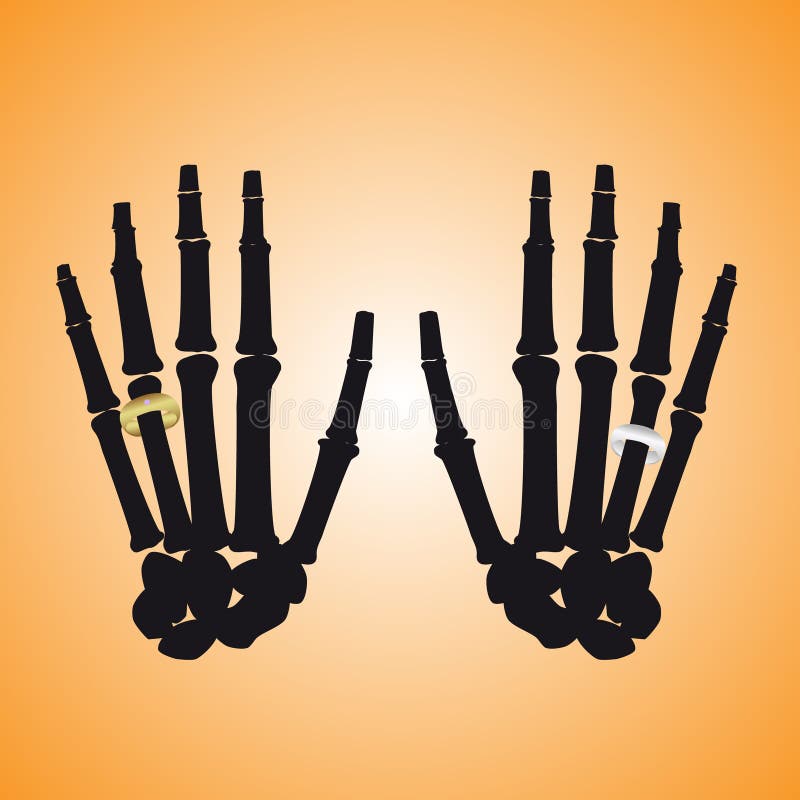 Human Hand Bones with Rings Stock Vector - Illustration of graphic ...