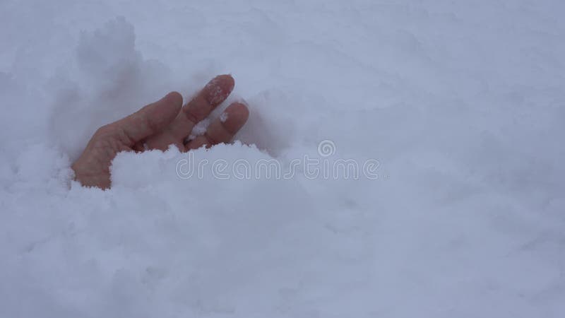 A Human Hand Comes Out of the Snow after an Avalanche. the Person Stuck ...