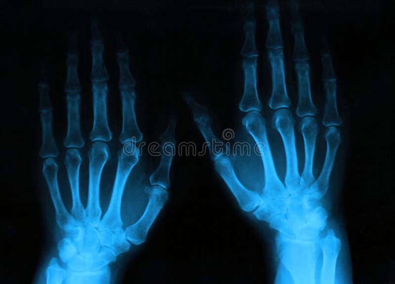 Two hands stock photo. Image of learn, hospital, physical - 26444