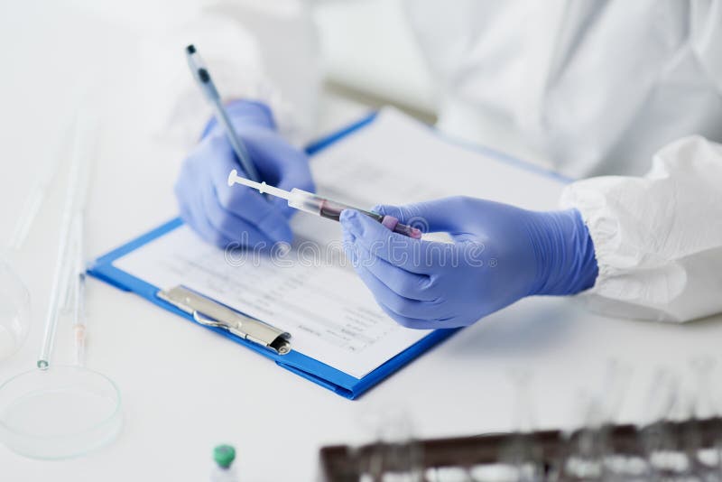 Analysis of Test Tube with a Sample Stock Photo - Image of analysis ...