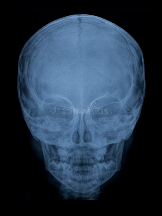 Human head and neck stock photo. Image of bone, nose - 246357140