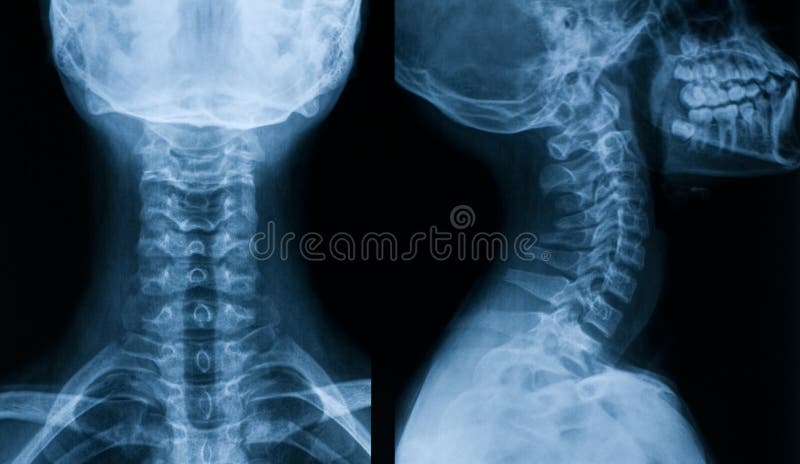 Human head and neck stock image. Image of chest, medicine - 246357149