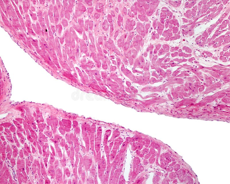 Human heart. Endocardium stock image. Image of heart - 243597117