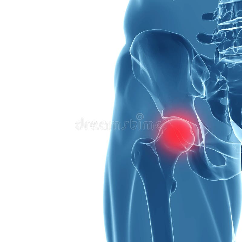 Human Hip Joint, Showing Area of Pain Stock Illustration - Illustration ...
