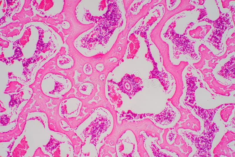 Hyaline Cartilage with Chondrocytes Stock Image - Image of lacuna ...