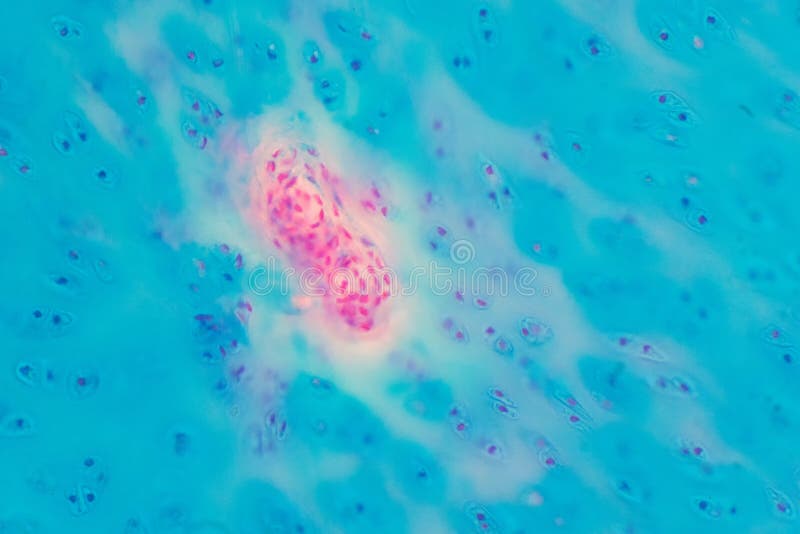 Hyaline Cartilage with Chondrocytes Stock Image - Image of lacuna ...