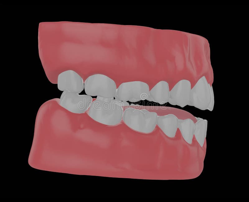 Human Jaw with Straight Teeth Stock Illustration - Illustration of dent ...