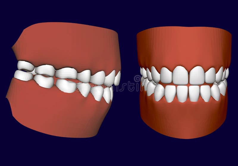 Human Jaw with Teeth. Side and Front View. 3D. Isolated Jaw on a White ...