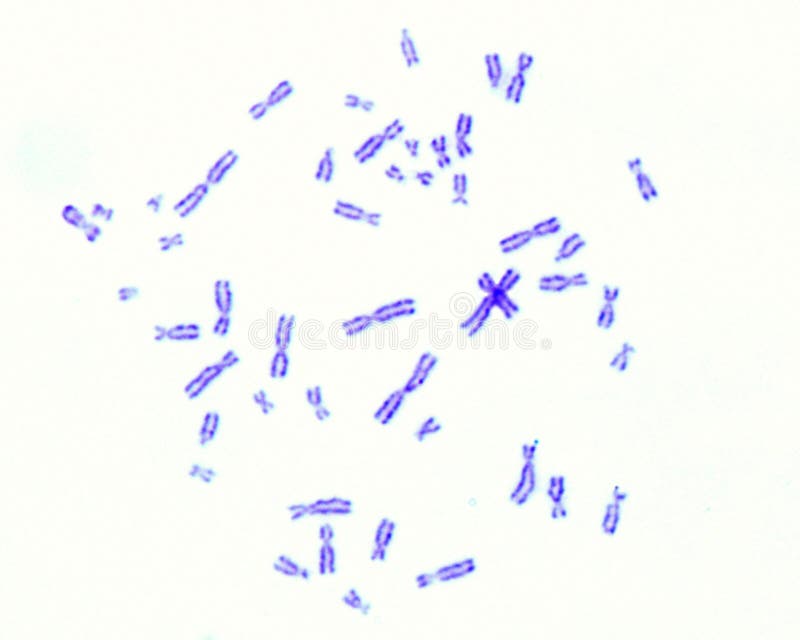 Human Karyotype. Chormosomes Stock Photo - Image of chromosomes, light ...