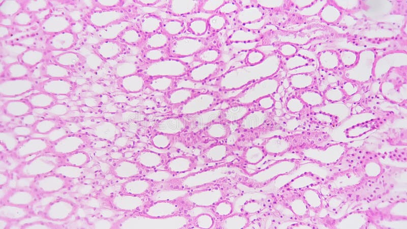 Human Kidney Tissue is Magnified in 200x Under Microscope and Filmed on ...