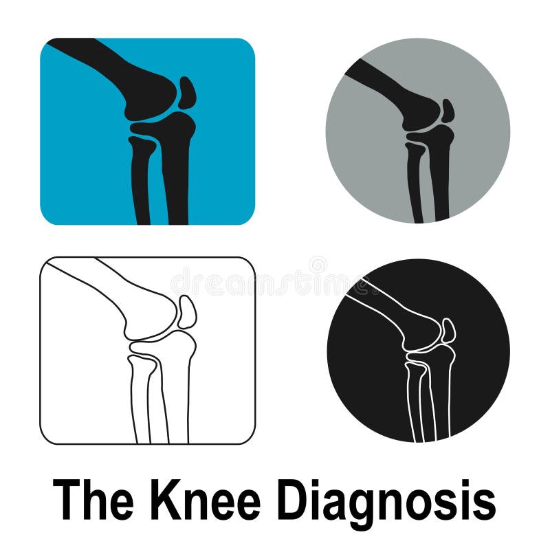 Human Knee Joint Side View Vector Illustration Design Isolated Concept ...