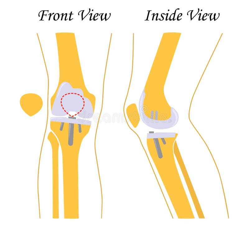 Human Knee Leg Front and Back View. Vector Illustration Stock Vector ...