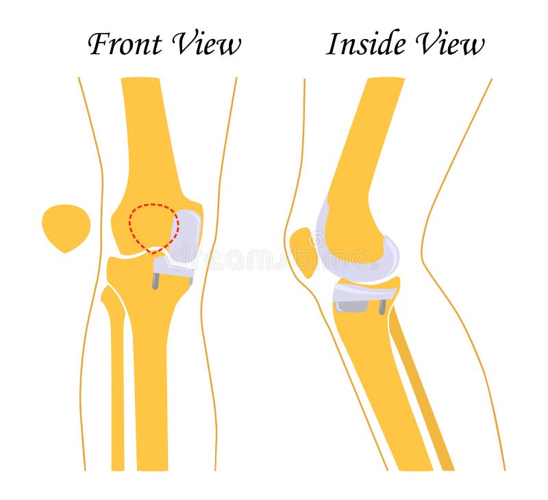 Human Knee Leg Front and Back View. Vector Illustration Stock Vector ...