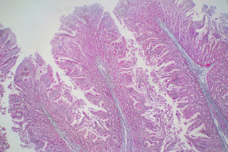 Human Large Intestine Tissue Under Microscope View. Stock Photo - Image ...