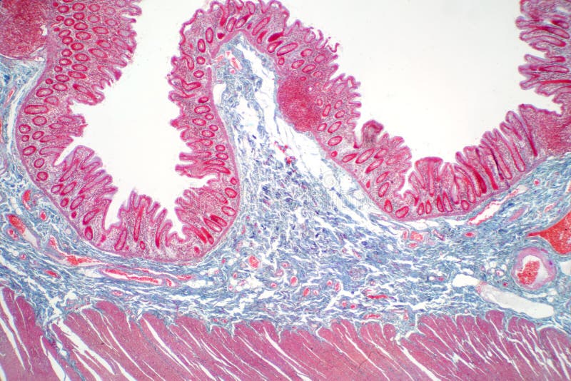 Human Large Intestine Tissue Under Microscope View. Stock Image - Image ...