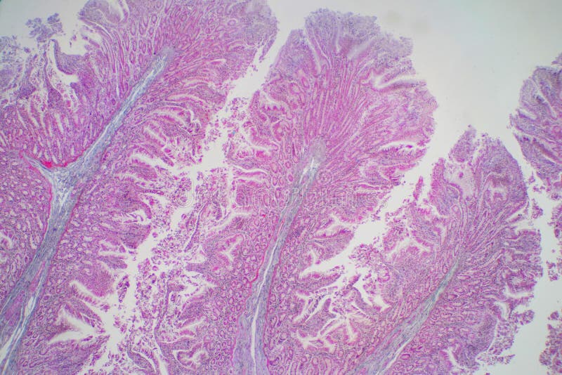 Human Large Intestine Tissue Under Microscope View Stock Image - Image ...