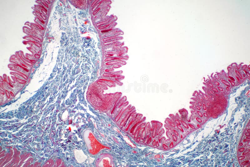Human Large Intestine Tissue Under Microscope View. Stock Image - Image ...