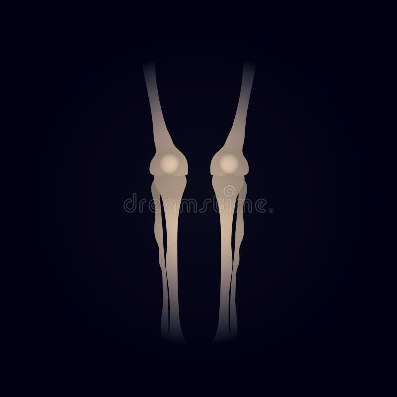 Human Leg Bone. Vector Illustration Decorative Background Design Stock ...
