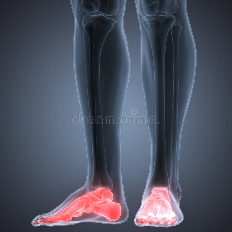 Human Leg Foot Joint Pains stock illustration. Illustration of ...