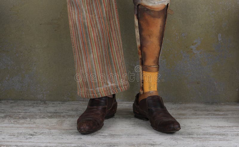 Human leg with prosthesis stock image. Image of injury - 335122569