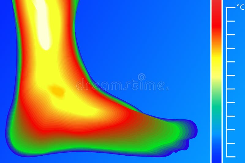 Human Leg. Thermal Imager with Temperature Scale. Stock Vector ...