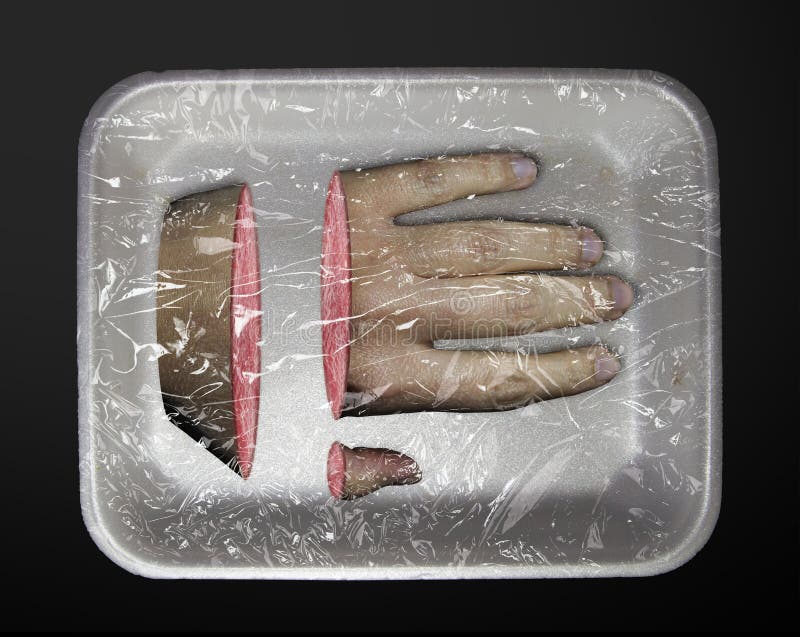 Human Limb in a Plastic Container Stock Illustration - Illustration of ...