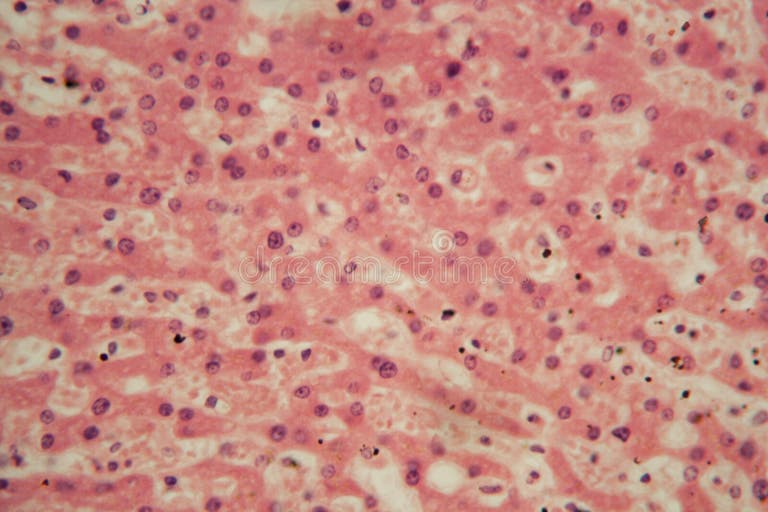 127 Tuberculosis Cells Stock Photos - Free & Royalty-Free Stock Photos ...