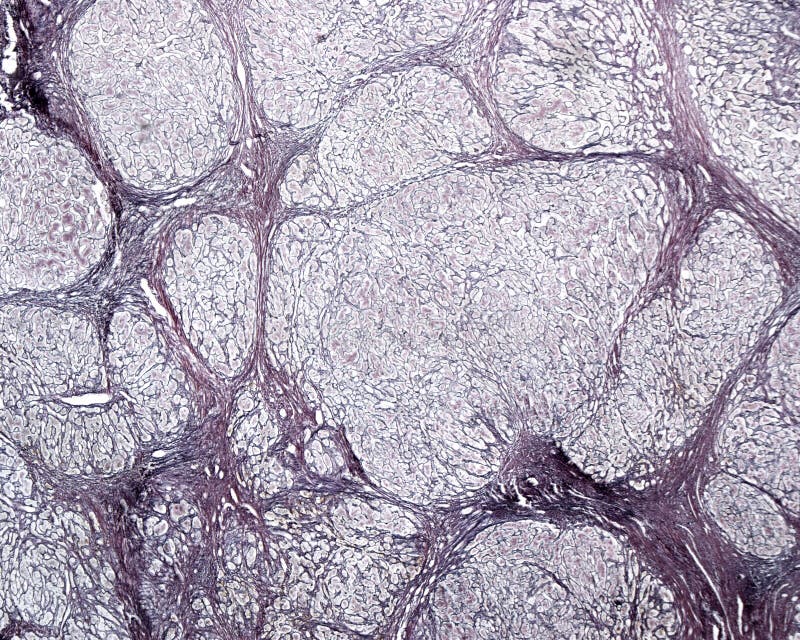 Histology Liver Reticular Stock Photos - Free & Royalty-Free Stock ...