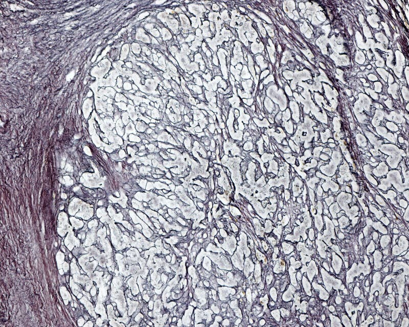 Histology Liver Reticular Stock Photos - Free & Royalty-Free Stock ...