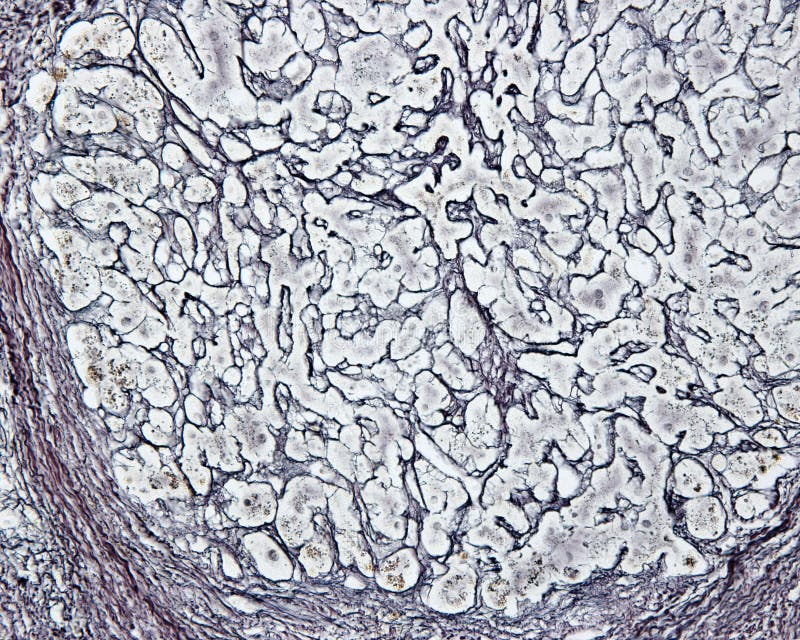 Histology Liver Reticular Stock Photos - Free & Royalty-Free Stock ...