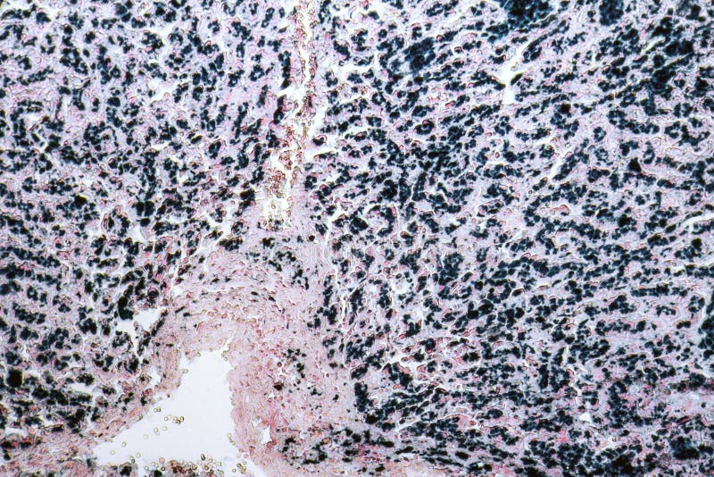 Human liver micrography stock photo. Image of translucent - 81502010